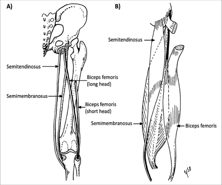 How to Know If You Pulled Your Hamstring | OrthoConnecticut