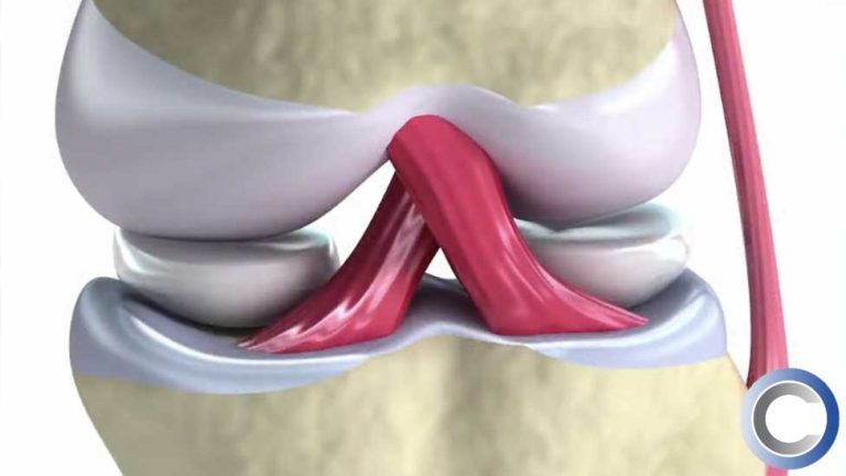 John Dunleavy, M.D. | OrthoConnecticut